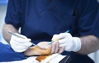 Morsure de chat, cas clinique médecine - Prévention Médicale